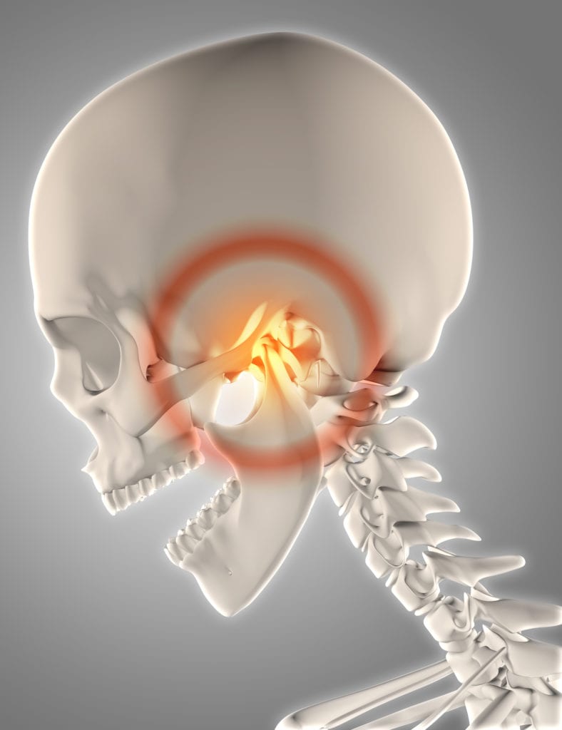 TMJ Symptoms & Treatment in Indianapolis, IN | Jaw Pain Indy